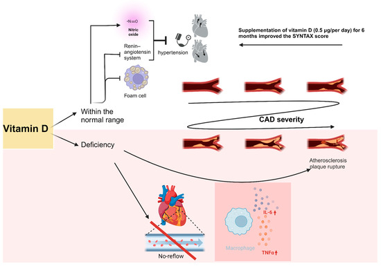 New Modifiable Risk Factors Influencing Coronary Artery Disease Severity