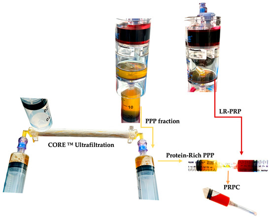 Profound Properties of Protein-Rich, Platelet-Rich Plasma Matrices as ...