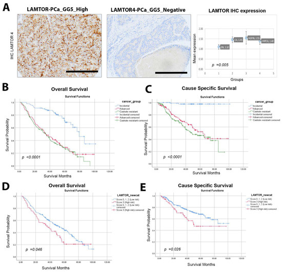 Elevated LAMTOR4 Expression Is Associated with Lethal Prostate Cancer ...