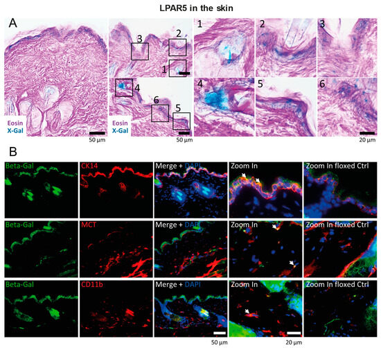 Lysophosphatidic Acid Receptors LPAR5 and LPAR2 Inversely Control ...
