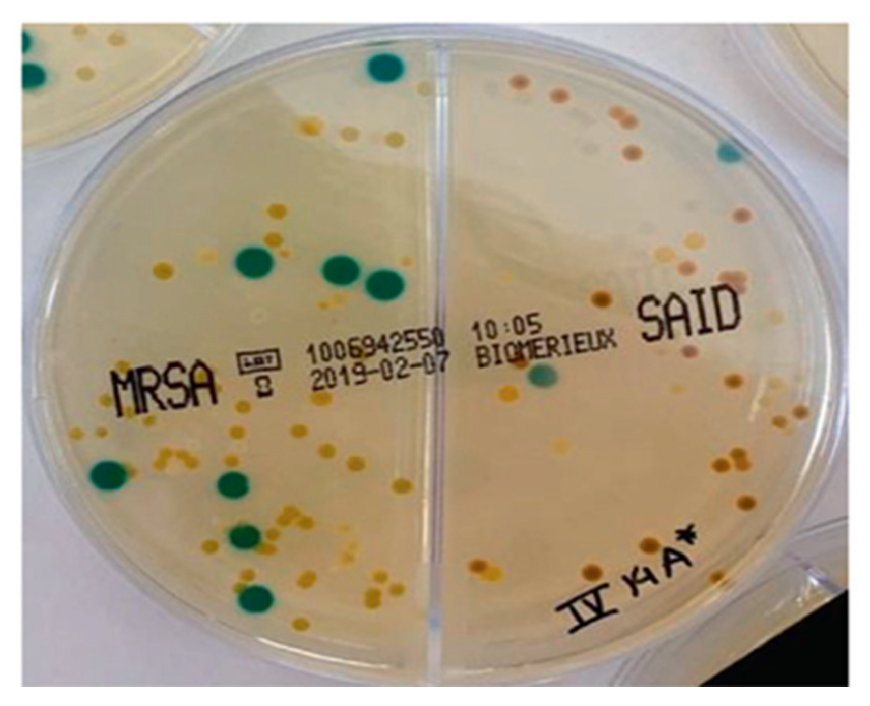 Degree of Contamination of Gutta-Percha Points by Staphylococcus aureus (MRSA/MSSA) Strains