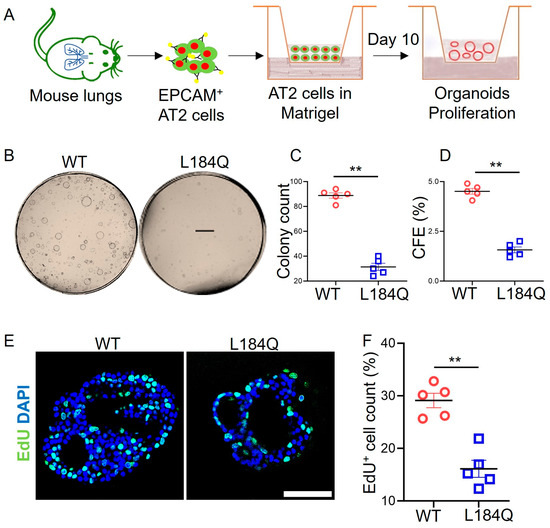 Humanized L184Q Mutated Surfactant Protein C Gene Alters Alveolar Type ...
