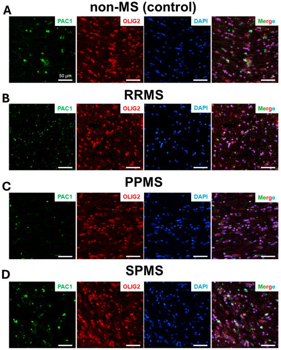 Differential Expression of PACAP/VIP Receptors in the Post-Mortem CNS ...