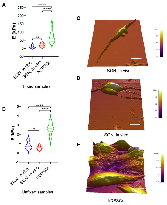 Differentiation of Spiral Ganglion Neurons from Human Dental Pulp Stem ...