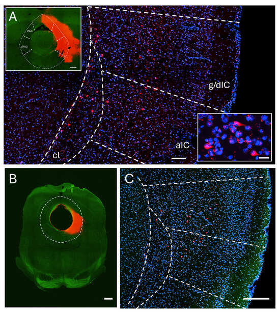 Multiple Posterior Insula Projections to the Brainstem Descending Pain ...