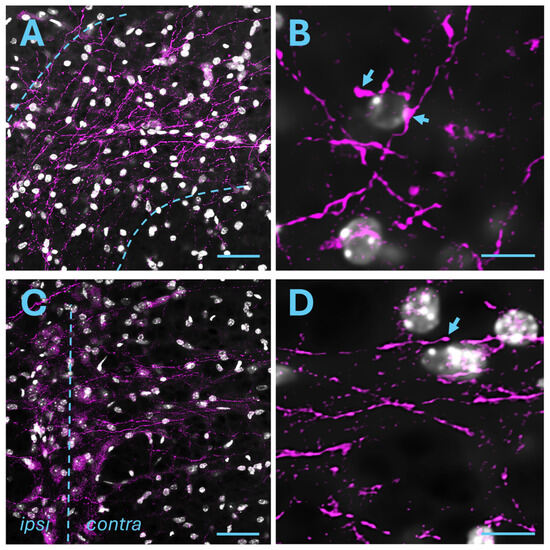 Multiple Posterior Insula Projections to the Brainstem Descending Pain ...