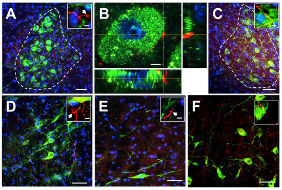 Multiple Posterior Insula Projections to the Brainstem Descending Pain ...
