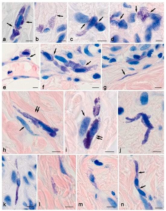 IJMS | Free Full-Text | The Contribution of Mast Cells to the ...