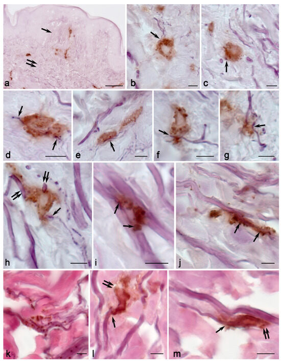 IJMS | Free Full-Text | The Contribution of Mast Cells to the ...
