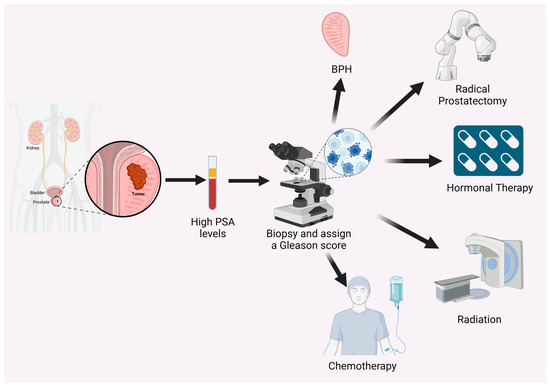 Heme Oxygenase-1 and Prostate Cancer: Function, Regulation, and ...