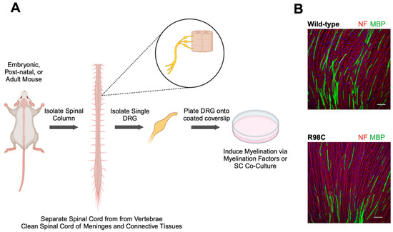 Navigating the Landscape of CMT1B: Understanding Genetic Pathways ...