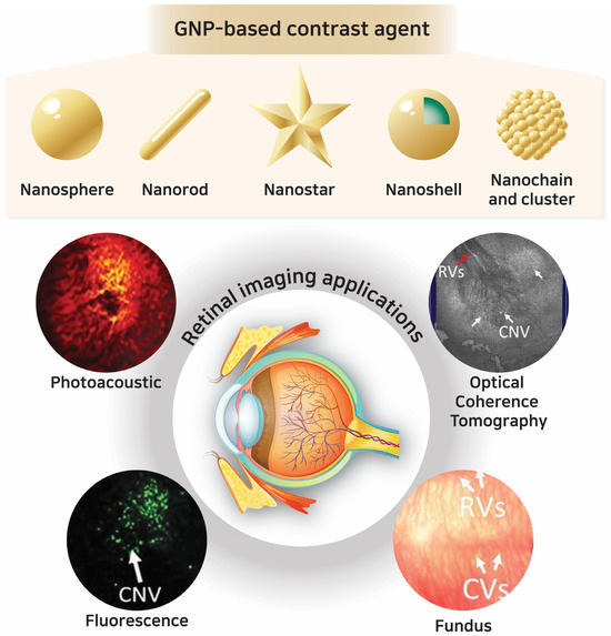 IJMS | Free Full-Text | Gold Nanoparticles for Retinal Molecular ...