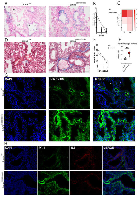 Inflammation and Fibrosis in Progeria: Organ-Specific Responses in an ...