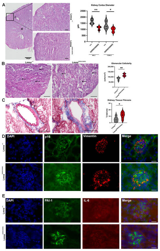 Inflammation and Fibrosis in Progeria: Organ-Specific Responses in an ...