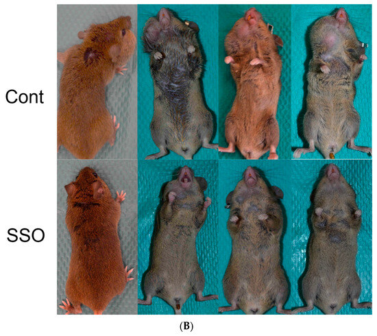 Targeting CD36-Mediated Lipid Metabolism by Selective Inhibitor ...