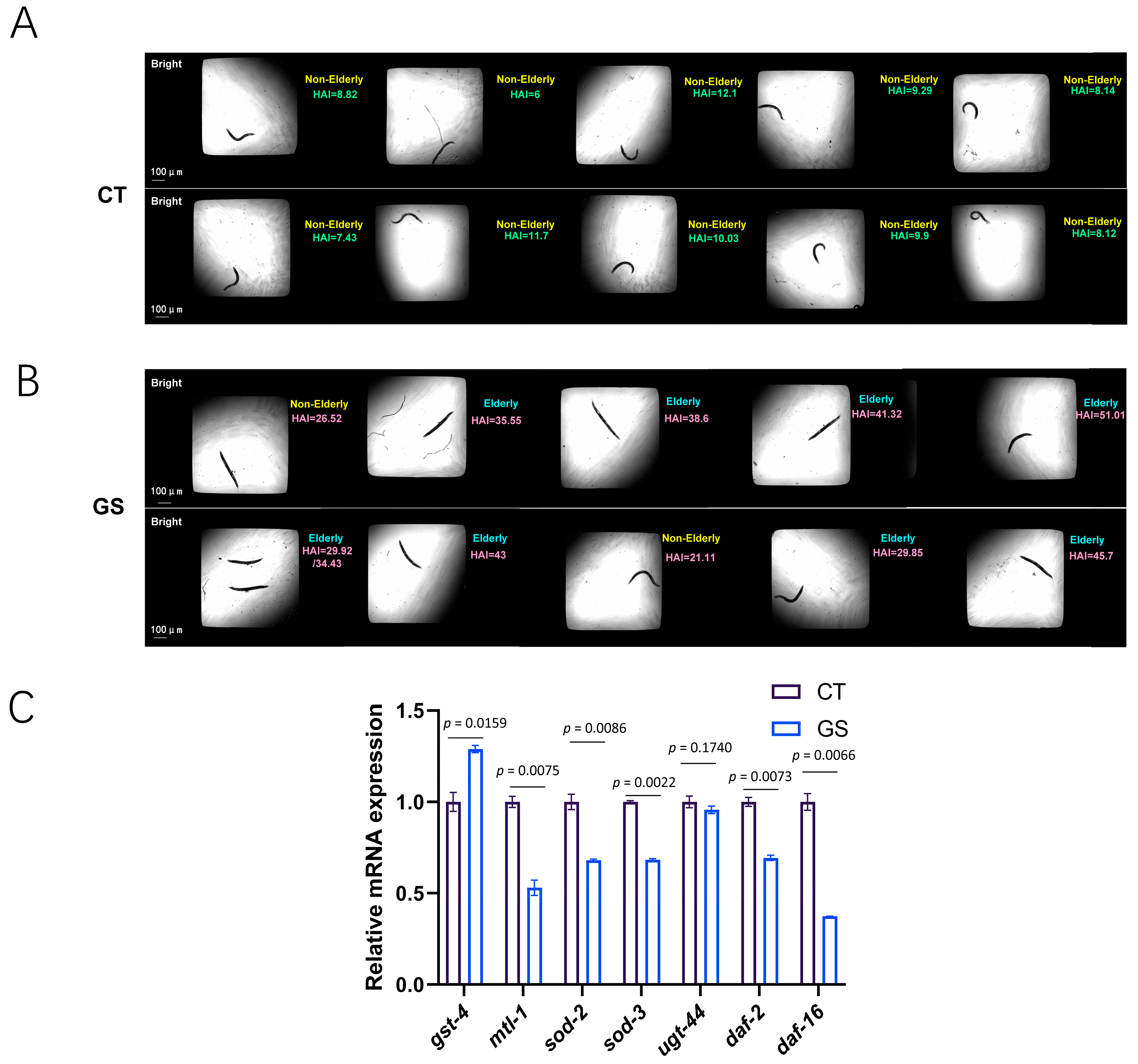 WormCNN-Assisted Establishment and Analysis of Glycation Stress Models in C. elegans: Insights ...