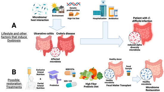 Insights into Gut Dysbiosis: Inflammatory Diseases, Obesity, and Restoration Approaches