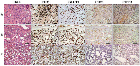 CD26 Is Differentially Expressed throughout the Life Cycle of Infantile ...