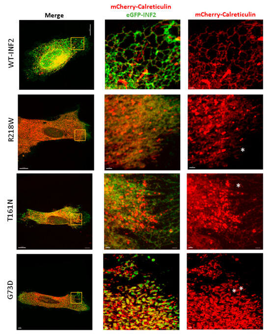 Altered Endoplasmic Reticulum Integrity and Organelle Interactions in ...