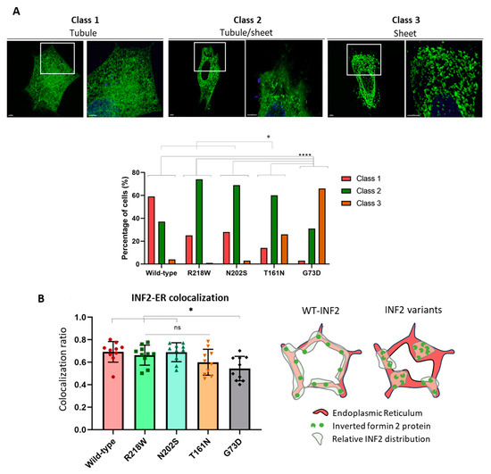 Altered Endoplasmic Reticulum Integrity and Organelle Interactions in ...