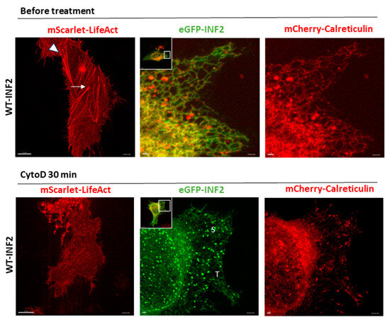 Altered Endoplasmic Reticulum Integrity and Organelle Interactions in ...