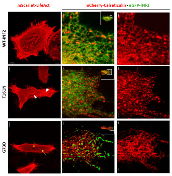 Altered Endoplasmic Reticulum Integrity and Organelle Interactions in ...