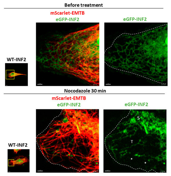 Altered Endoplasmic Reticulum Integrity and Organelle Interactions in ...