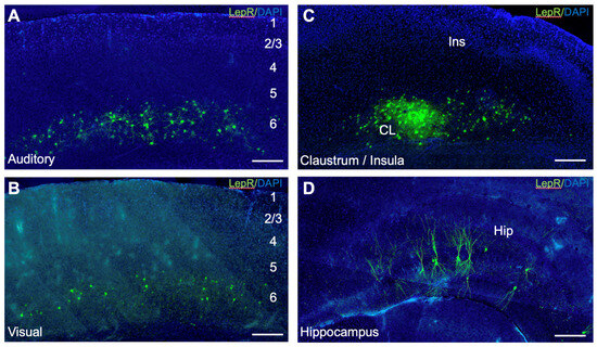 Cell-Type-Specific Expression of Leptin Receptors in the Mouse Forebrain