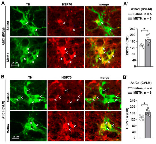 Methamphetamine-Induced Blood Pressure Sensitization Correlates with ...