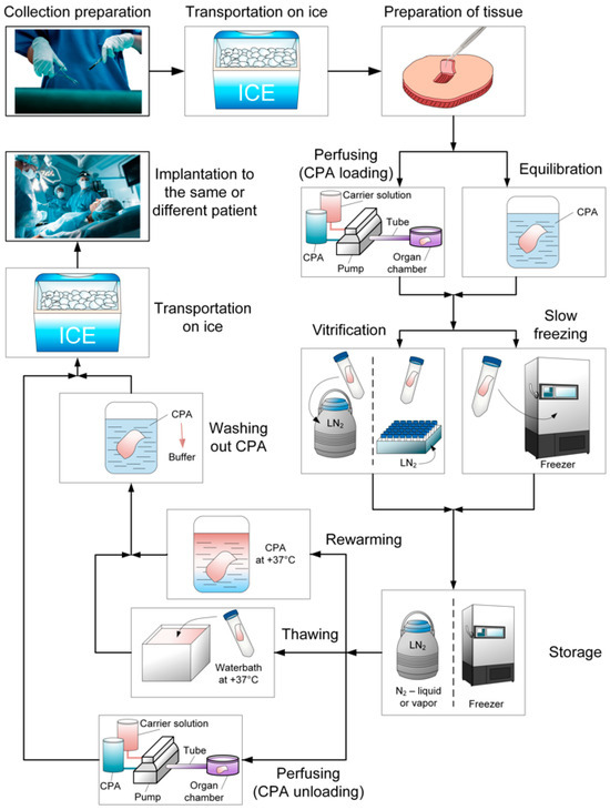 Current State and Challenges of Tissue and Organ Cryopreservation in Biobanking
