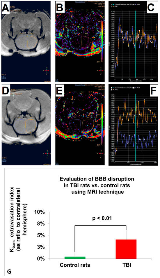 Evaluation of Blood–Brain Barrier Disruption Using Low- and High ...