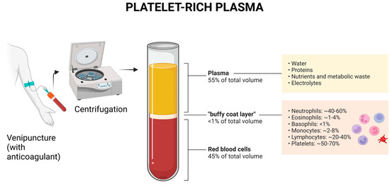 Regenerative Inflammation: The Mechanism Explained from the Perspective of Buffy-Coat ...