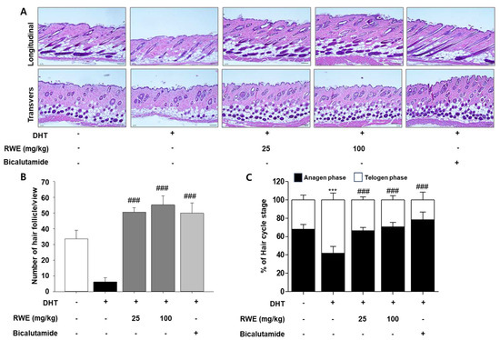 Hair Growth Effect and the Mechanisms of Rosa rugosa Extract in DHT ...