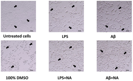 Noradrenaline Protects Human Microglial Cells (HMC3) Against Apoptosis ...