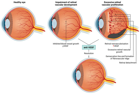 Molecular and Cellular Mechanisms Involved in the Pathophysiology of ...