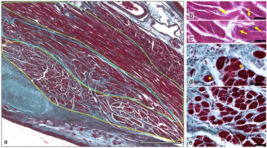 Morphological Evidence for a Unique Neuromuscular Functional Unit of ...