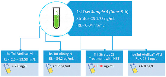 Troponin Test, Not Only a Number: An Unusual Case of False Positive