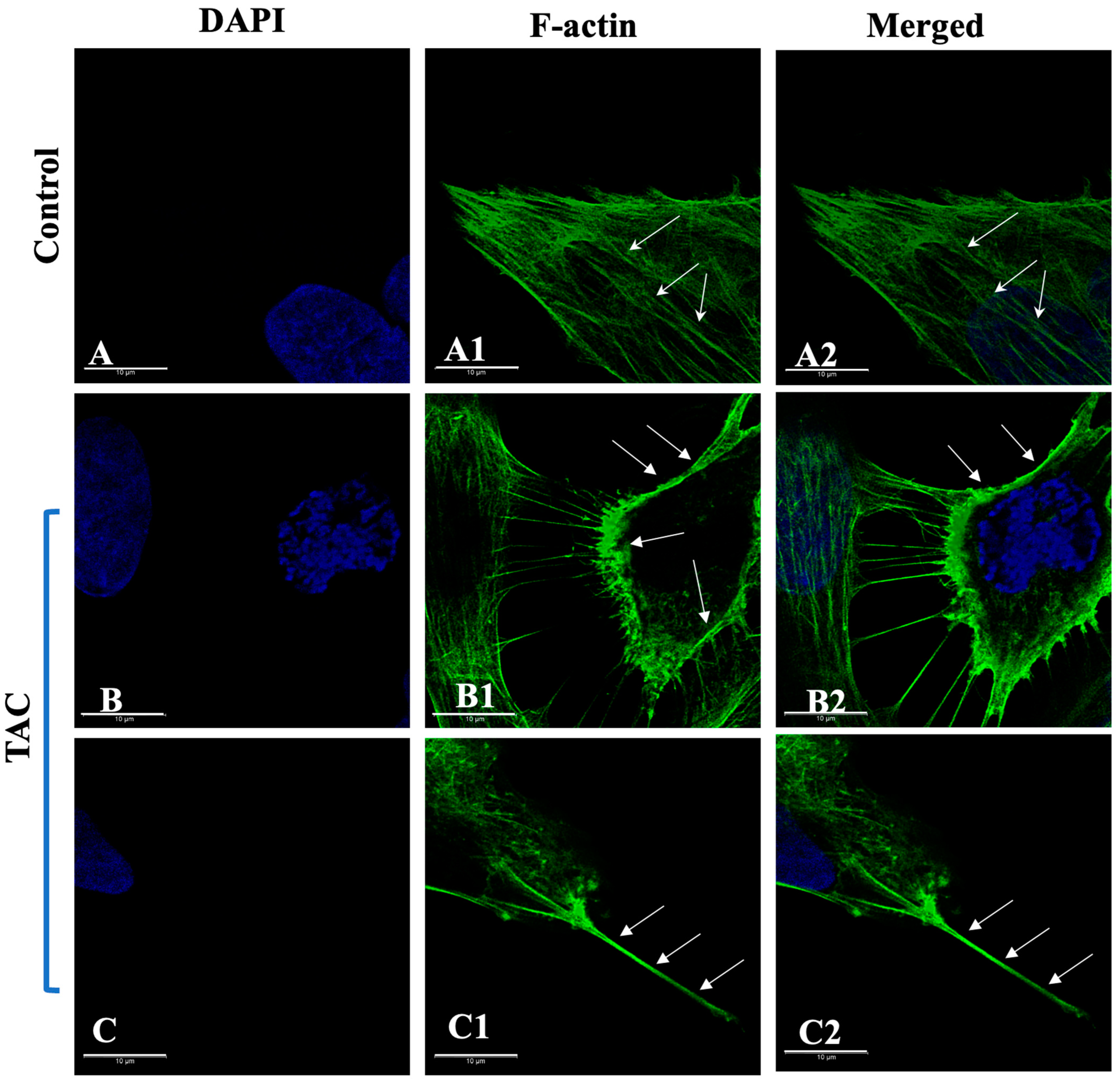 An Immune-Independent Mode of Action of Tacrolimus in Promoting Human ...