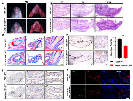 PTH1R Suppressed Apoptosis of Mesenchymal Progenitors in Mandibular Growth
