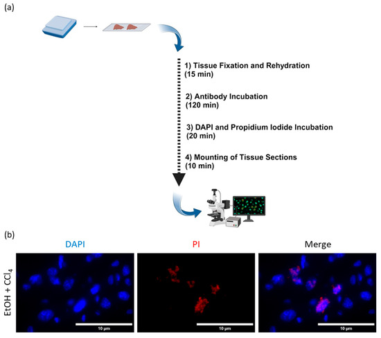 Wanted: Dead or Alive Cells with Propidium Iodide Staining in Liver Tissue