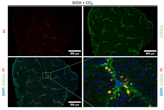 Wanted: Dead or Alive Cells with Propidium Iodide Staining in Liver Tissue