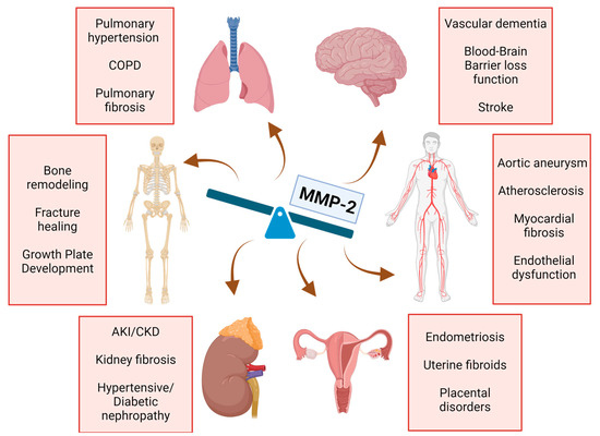 The Complex Role of Matrix Metalloproteinase-2 (MMP-2) in Health and ...