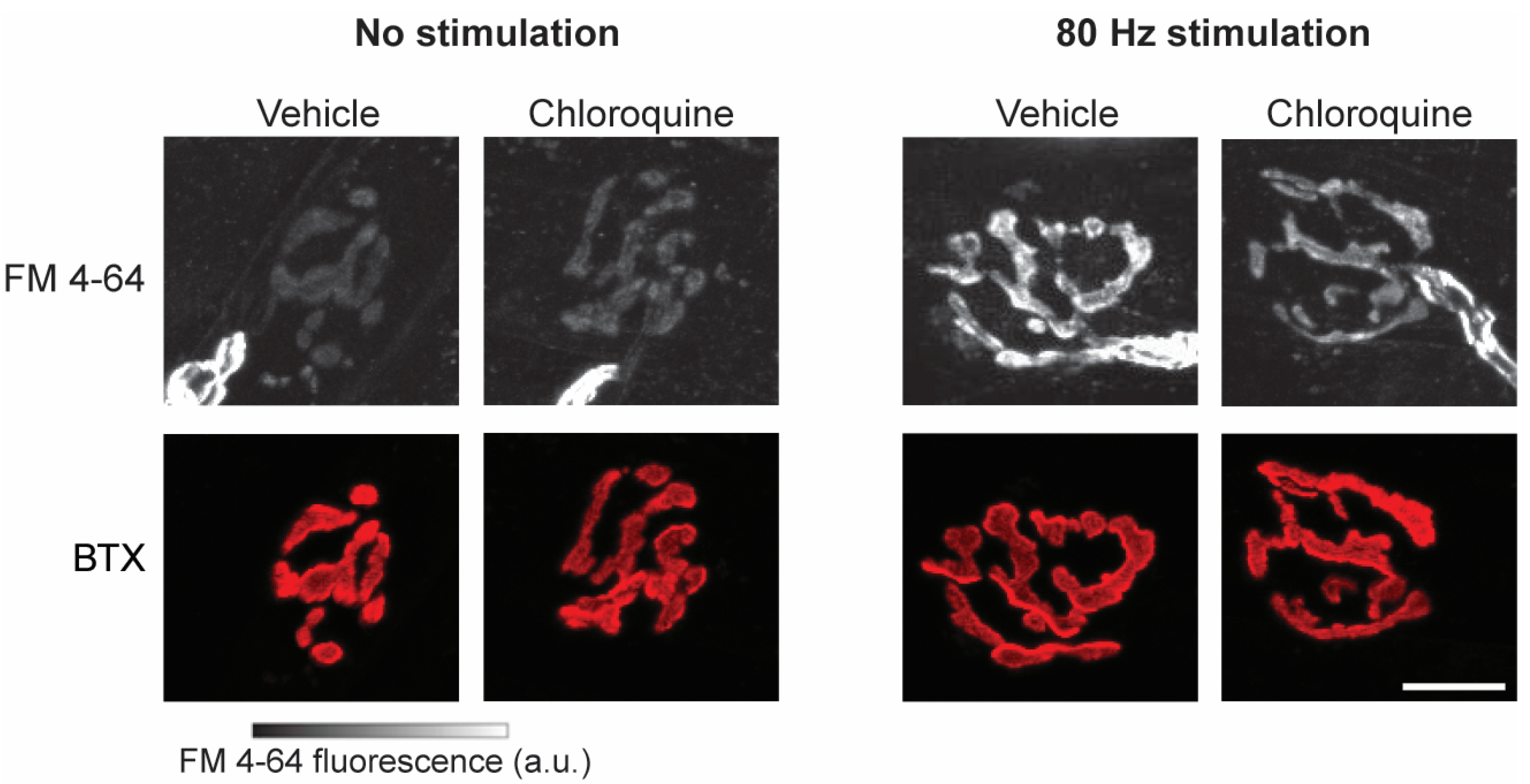 Chloroquine Affects Presynaptic Membrane Retrieval in Diaphragm ...