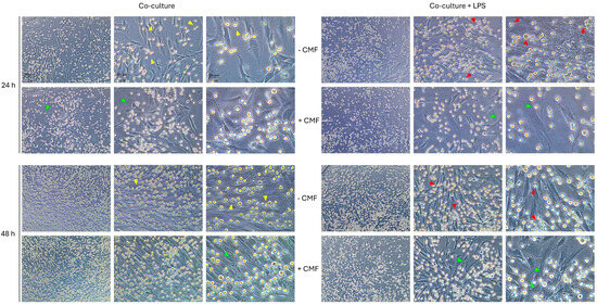 The Immunophenotype and the Odontogenic Commitment of Dental Pulp Stem ...