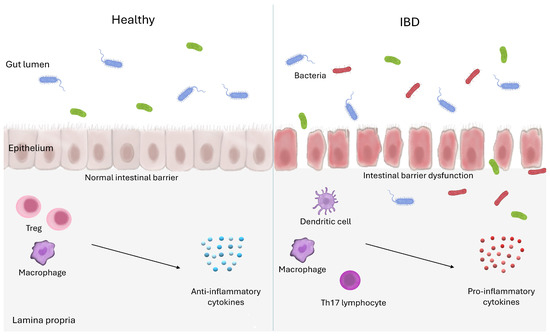 Key Interleukins in Inflammatory Bowel Disease—A Review of Recent Studies