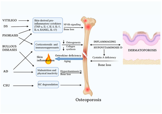 Skin Disorders and Osteoporosis: Unraveling the Interplay Between ...