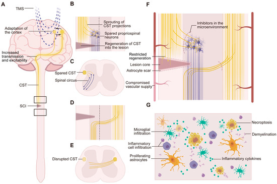 Repetitive Transcranial Magnetic Stimulation for the Treatment of ...