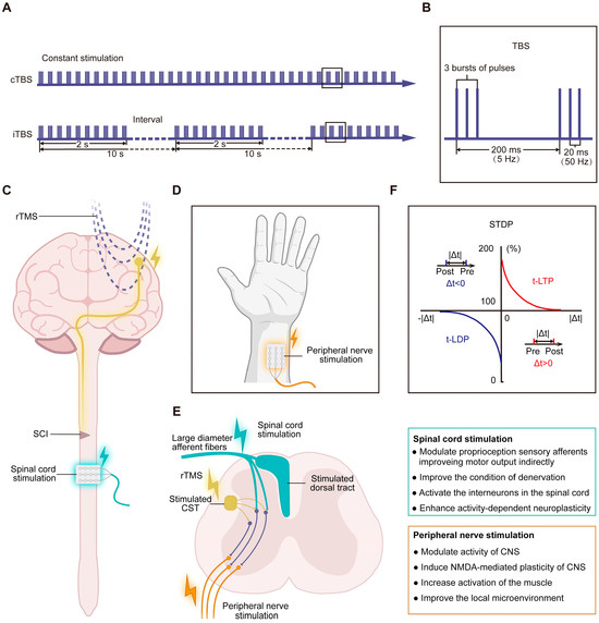 Repetitive Transcranial Magnetic Stimulation for the Treatment of ...
