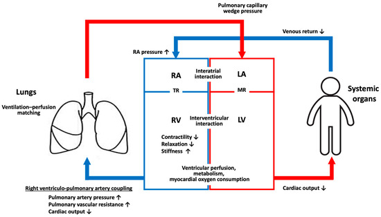 Pathophysiology of Group 3 Pulmonary Hypertension Associated with Lung ...