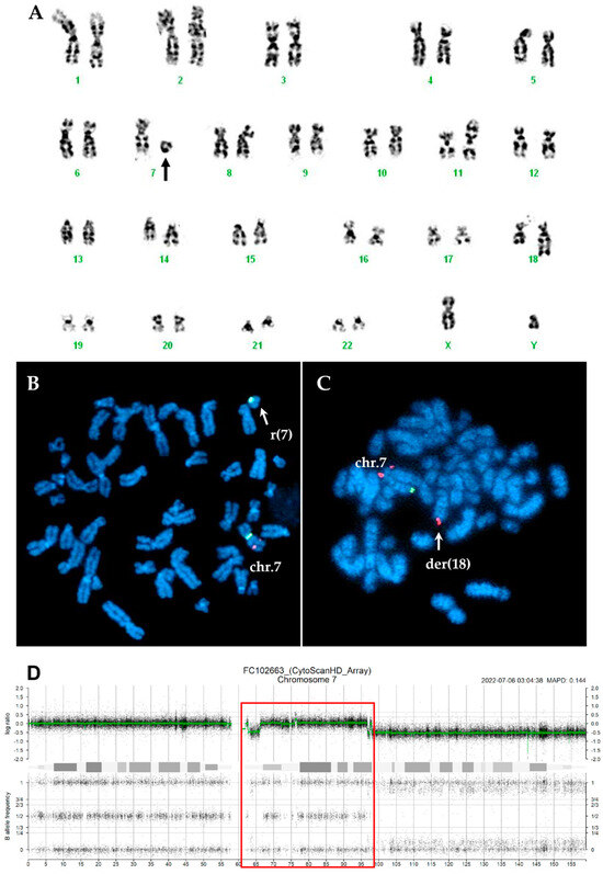 Emergence and Cytogenetic Clonal Evolution of Chromosome 7 ...